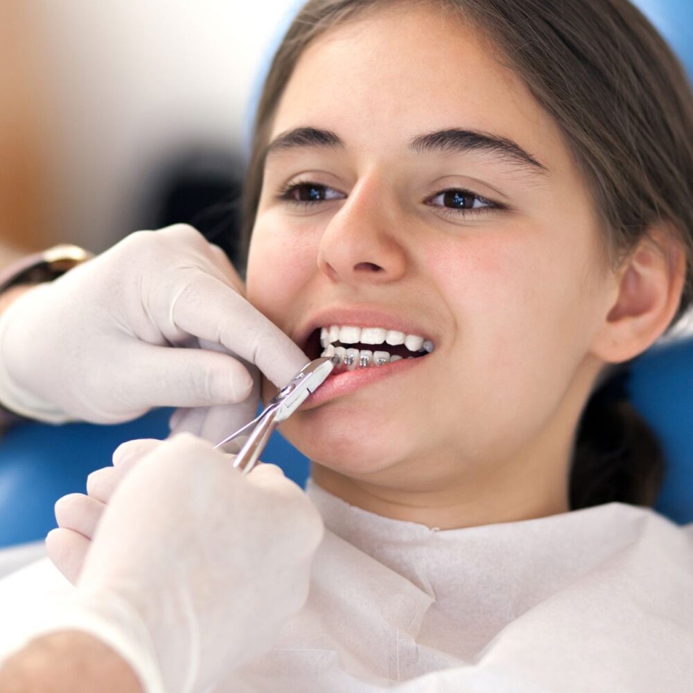 Caseum amigdalar: causas, síntomas y tratamiento | Dentinos